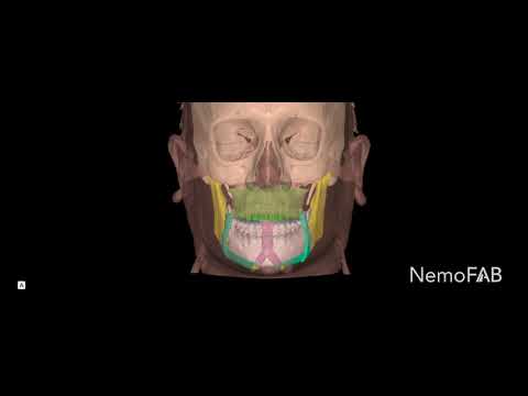 Maxilofacial Surgery Planning