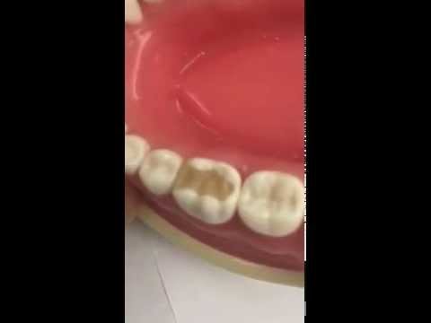 Composite sample