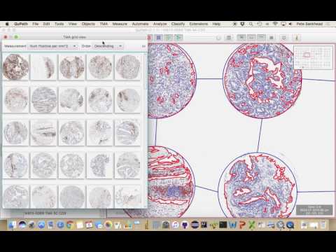 TMA CD3 analysis · qupath/qupath Wiki · GitHub