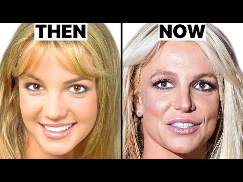 Plastic surgeon makes face analysis of Britney throughout the years ...