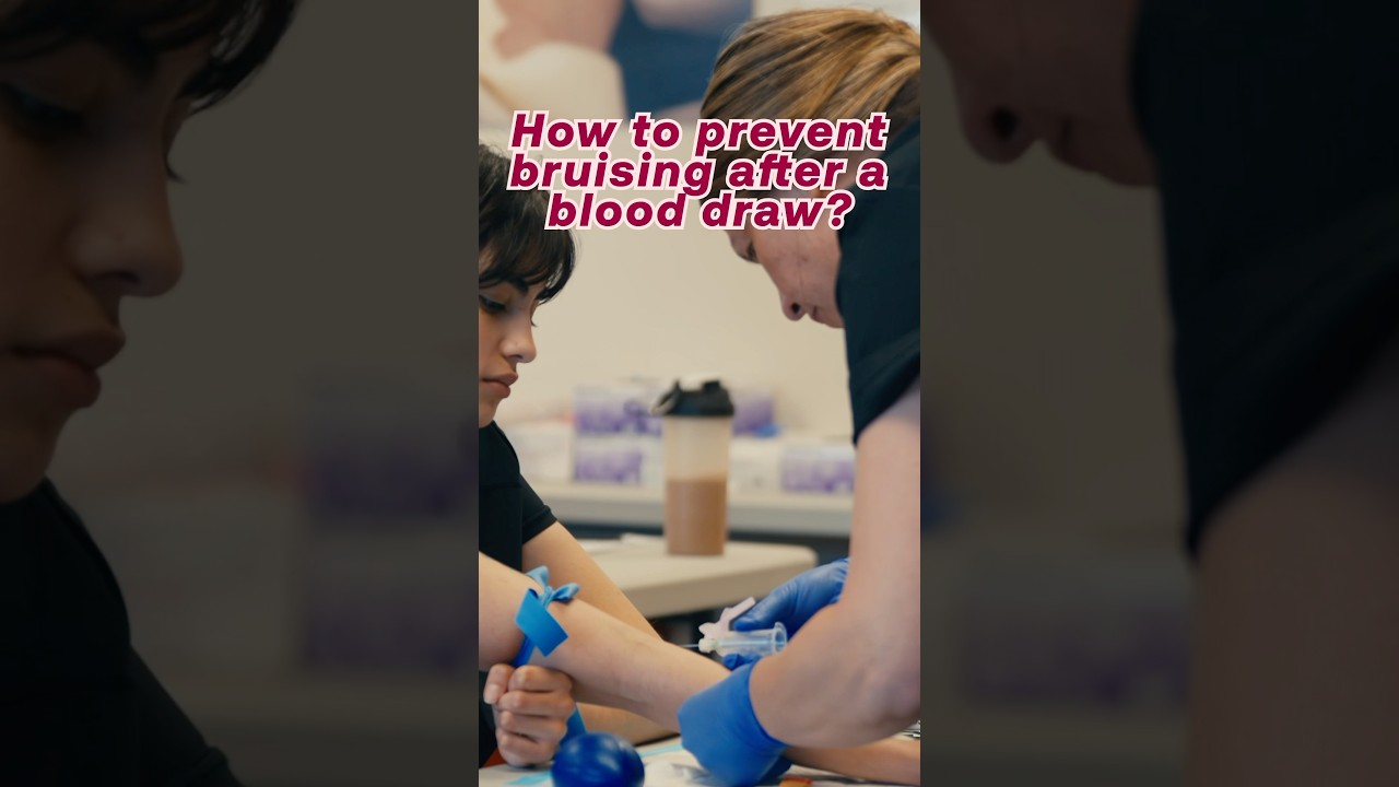 How to prevent bruising after a draw