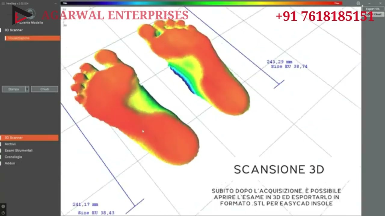 Podoscan 3D