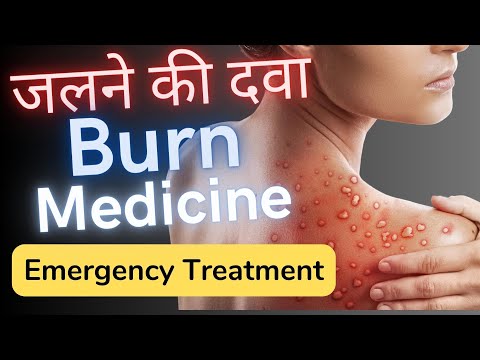 Jalne par kya lagana chahiye | Burn medicine in Hindi | Jalne ka ilaj | burn medicine in Hindi