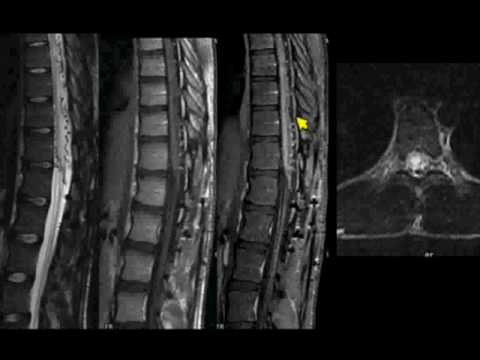 RadPod Spine Imaging Case 7.wmv