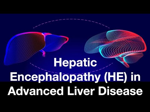 Hepatic Encephalopathy (HE) in Advanced Liver Disease