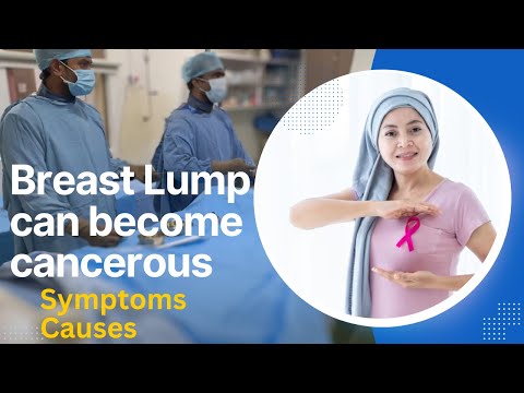 Breast Lump can become cancerous | Breast Cancer | Breast Lump