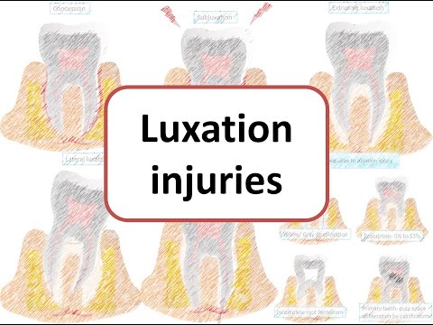 Luxation Injuries: Concussion, Subluxation, Extrusive, Lateral & intrusive luxation