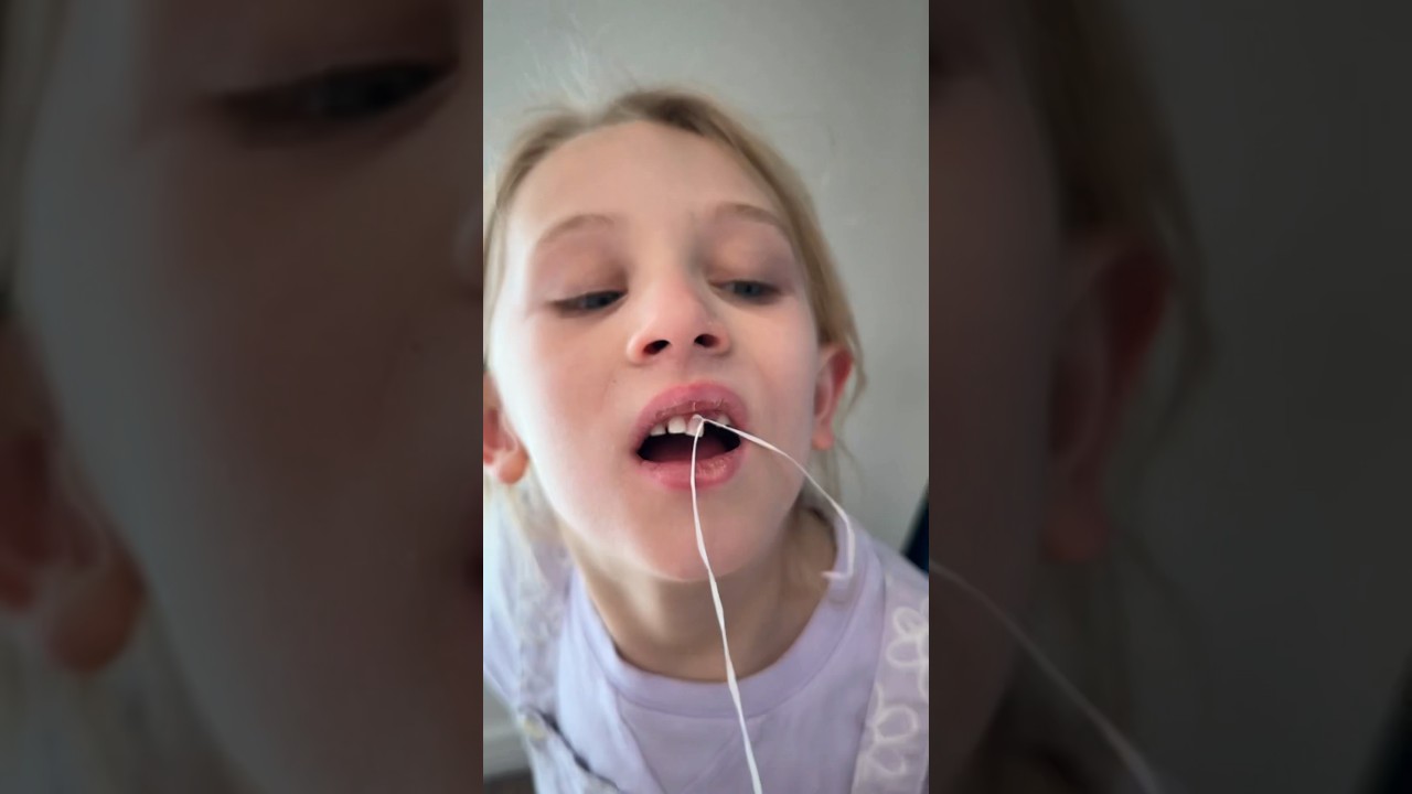 Trap door pulls tooth! 🦷 😭