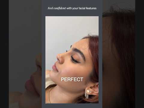 Insecure about your Nose? Watch this.