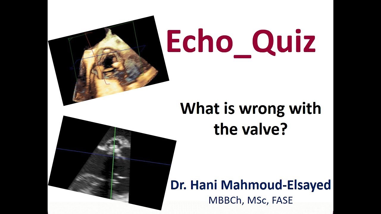 Echo_Quiz: What is wrong with the valve?