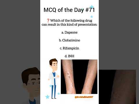 "High-yield FMGE MCQ of the day! Test yourself and comment your answer! #FMGEprep #MedicalStudents"