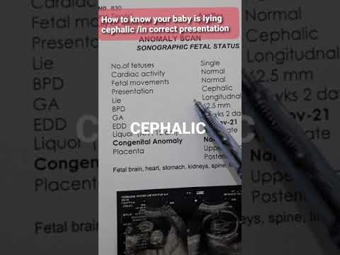 Bacha paet me sedha hae ya ni? ultrasound ki report se kesae pata chale ?