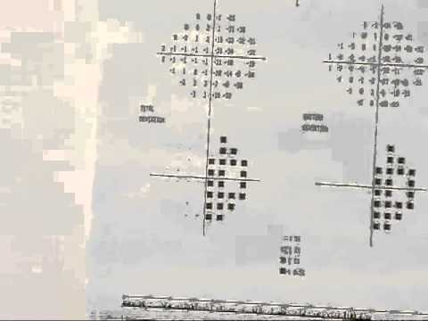 Formal Visual Field Testing