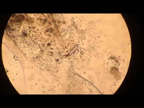 Dog itch mite