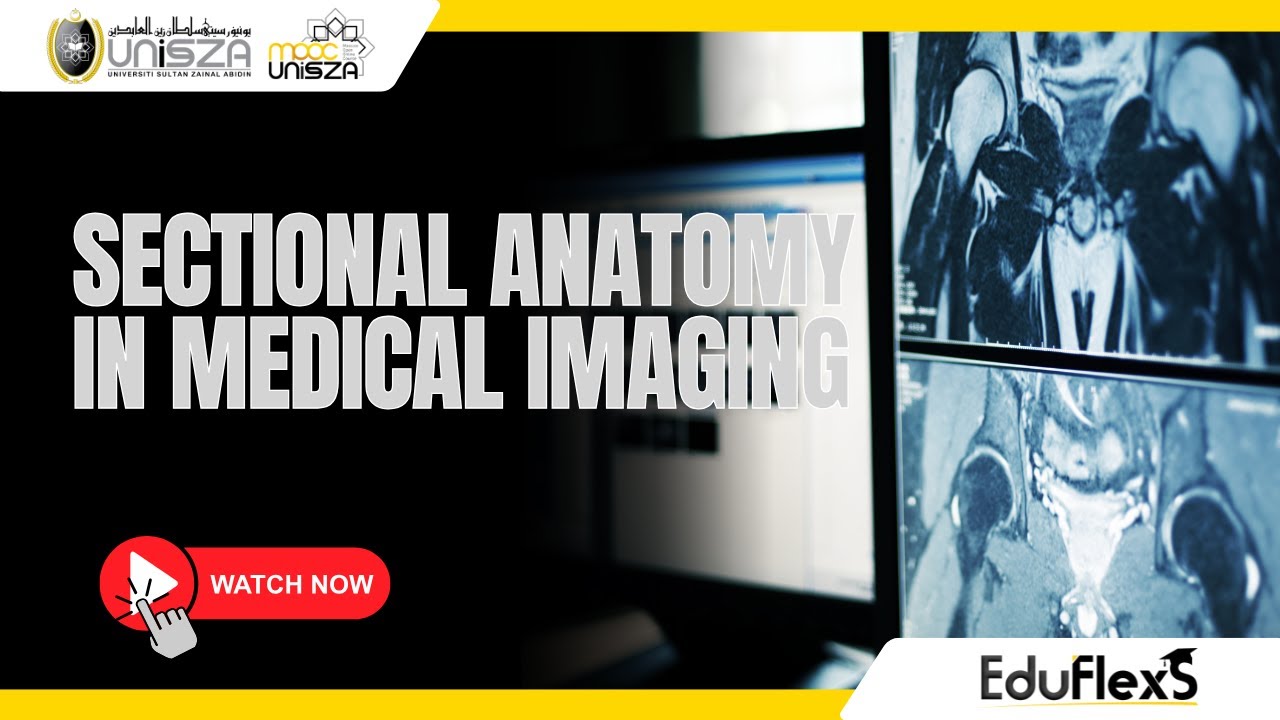 Sectional Anatomy in Medical Imaging | EduFlexS UniSZA