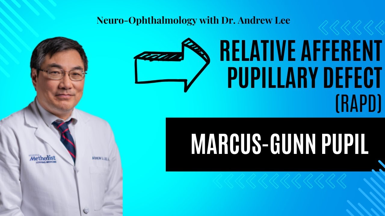 RAPD, Relative Afferent Pupillary Defect, Marcus-Gunn pupil