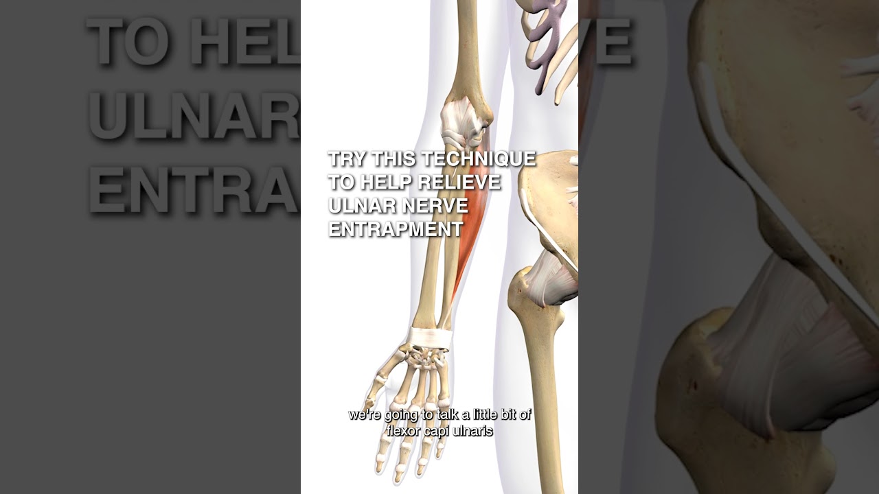 Try This Technique to Help Relieve Ulnar Nerve Entrapment