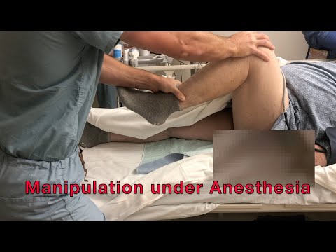 Manipulation under Anesthesia