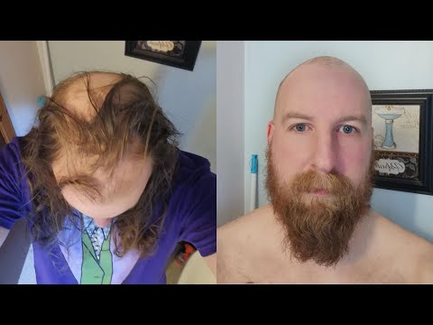YouTube's BaldCafe Helps Balding Men Love Their Shaved Heads