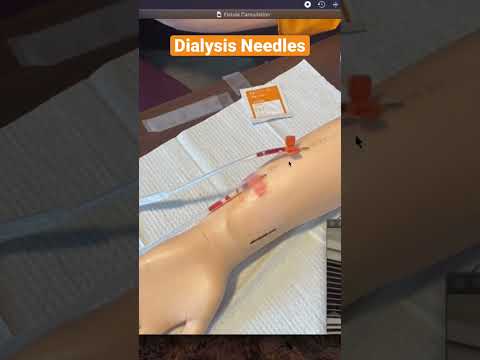 Mastering Dialysis - Learn How To Insert Needles For AV Fistula!
