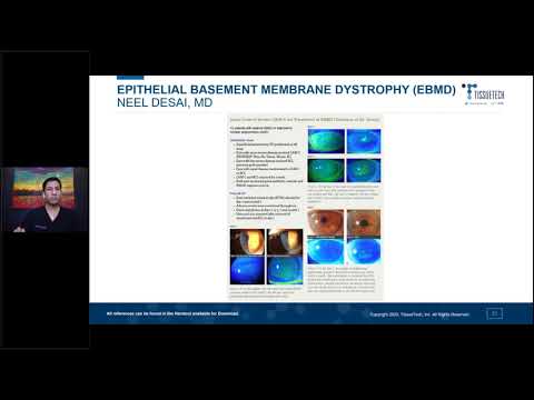 Dr. Desai details his study of 10 patients with bi-lateral EBMD
