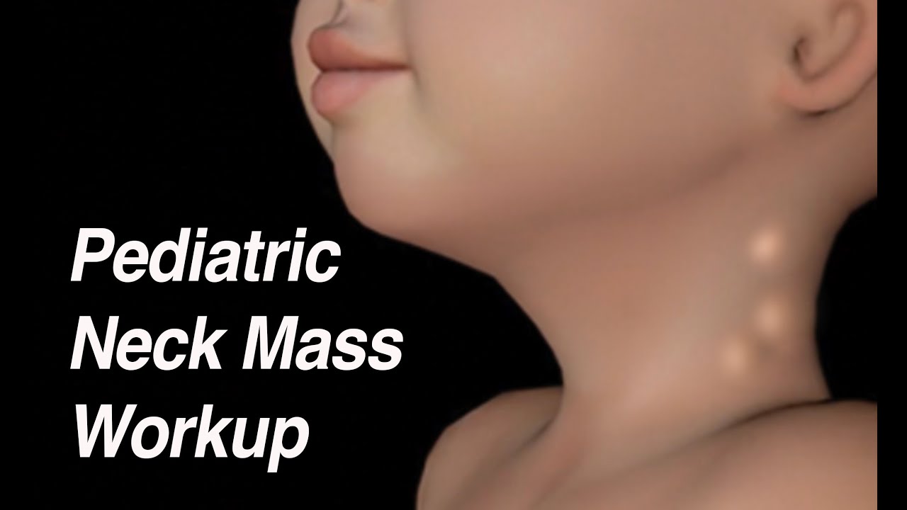 Pediatric Neck Mass Workup - What Happens Next?