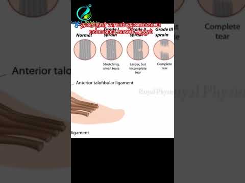 Ligament injury recovery exercises in tamil | acl rehab | acl | Acl recovery gym exercise | physio