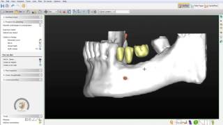 SimPlant GO Reviews May 2026: Pricing & Features | SoftwareWorld