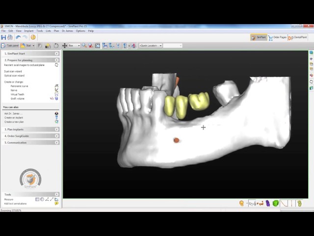 Simplant Pricing, Features & Reviews 2021 - Free Demo