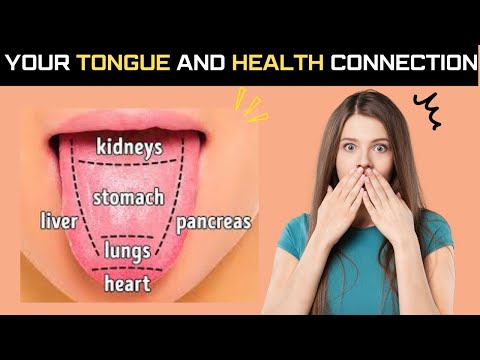 Why Your Tongue Turns White and 5 Ways to Get Rid of it.