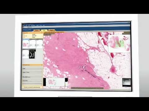 Pathology Solutions - Philips Digital Pathology