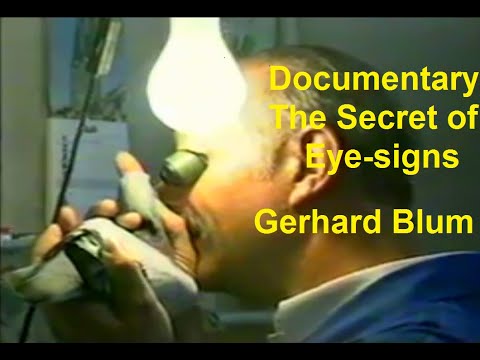 Eye-signs of Racing Pigeons-Part 01-