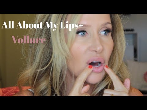 Natural Looking Lip Filler~ Vollure XC