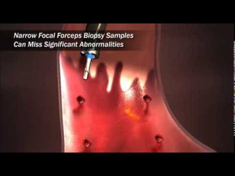 CDx Diagnostics® (WATS3D) - 3d animation produced by virtual-point.com