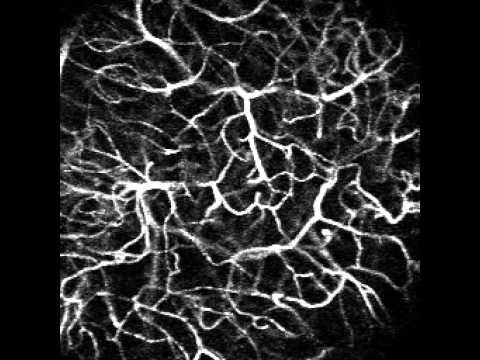Brain Imaging Time-Lapse | Time-Lapse Blog