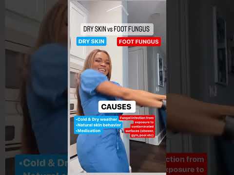 Dry Skin VS Foot Fungus #fungalinfections #athletesfoot #footdoctor