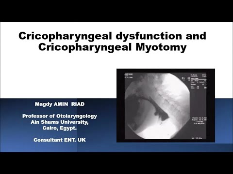 Cricopharyngeus dysfunction & Cricopharyngeal Myotomy