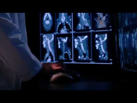 ARA TV Ad-Your Radiologist