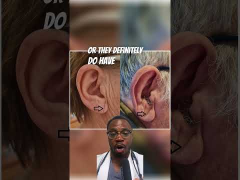 Doctor reacts. What happened to THEIR EARS! #heart #shorts #health
