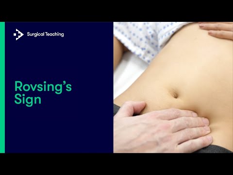 Rovsing's sign