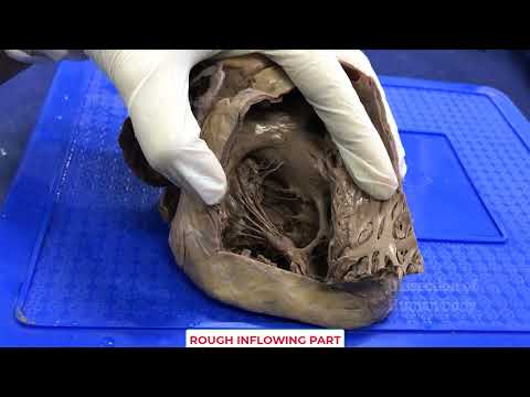 Interior of right ventricle: Clinical and Embryological significance