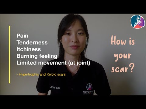 Scar Tissue Management | Part 1