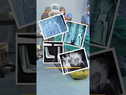 Best Orthopaedic Surgeon Lucknow Uttar Pradesh India #shorts #viral #trending #lucknow #uttarpradesh