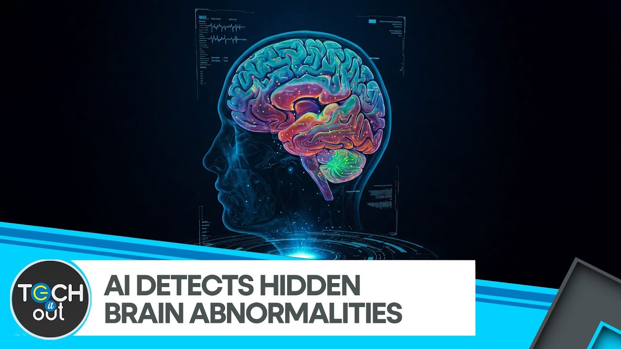 New Hope For Epilepsy Patients | WION Tech IT Out