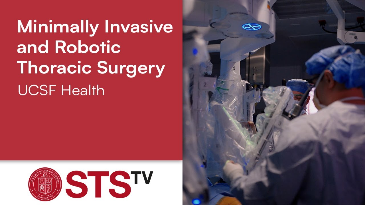 UCSF Thoracic Surgery – At the Forefront of Medical and Surgical Innovation