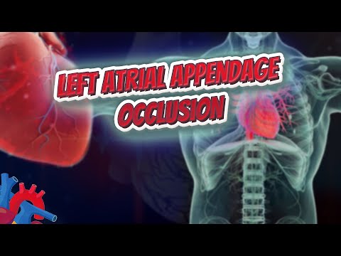 Left atrial appendage occlusion - Human Heart and Cardiology ❤️❤️❤️🔊✅