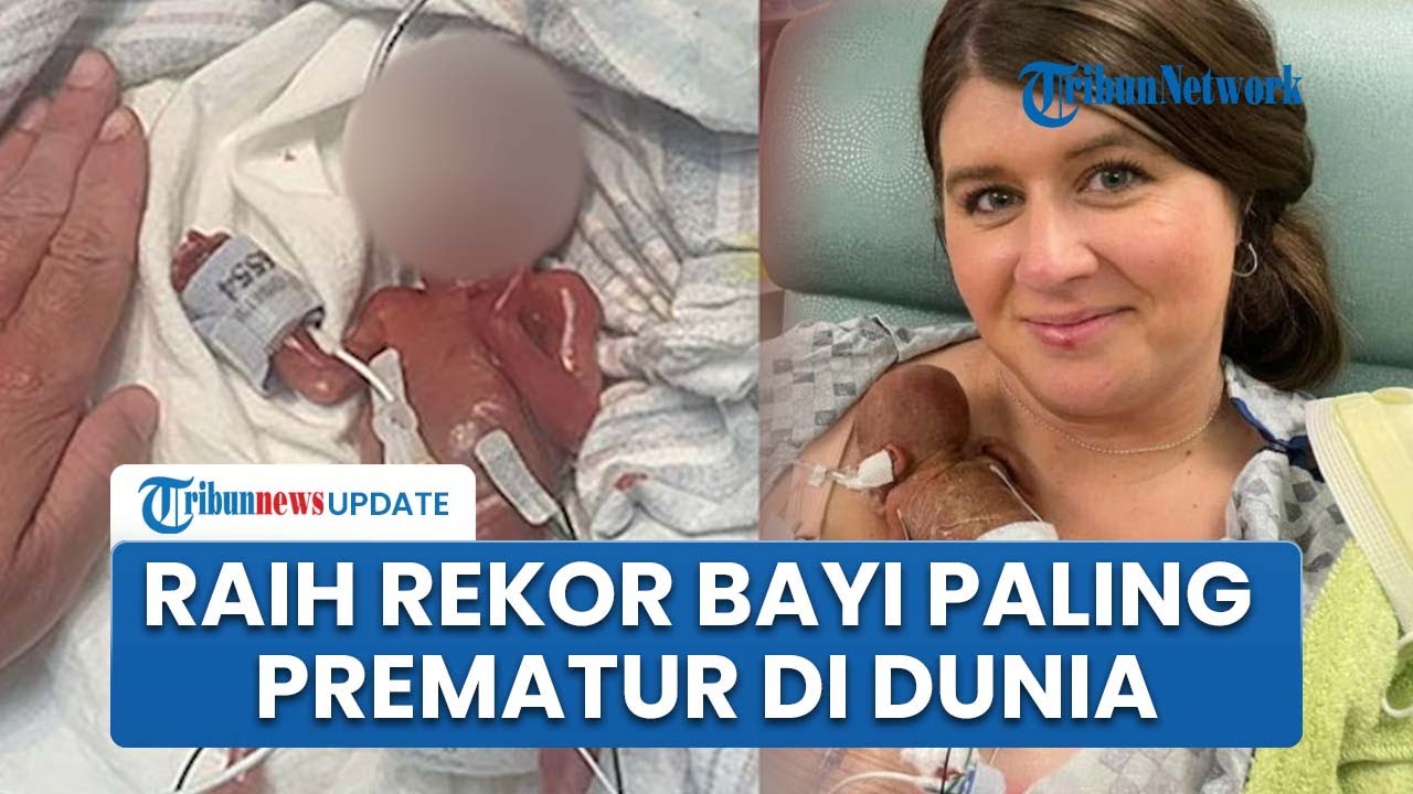 Bayi Peraih Rekor 'Paling Prematur di Dunia' Asal Iowa Amerika Serikat ...