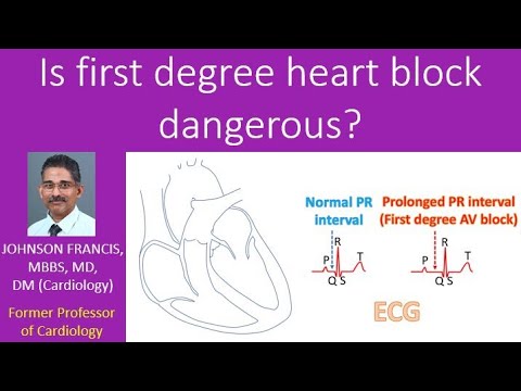 Is first degree heart block dangerous?