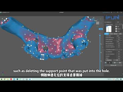 How To Print Ortho Surgical Guide with 3D Printer In Right Way