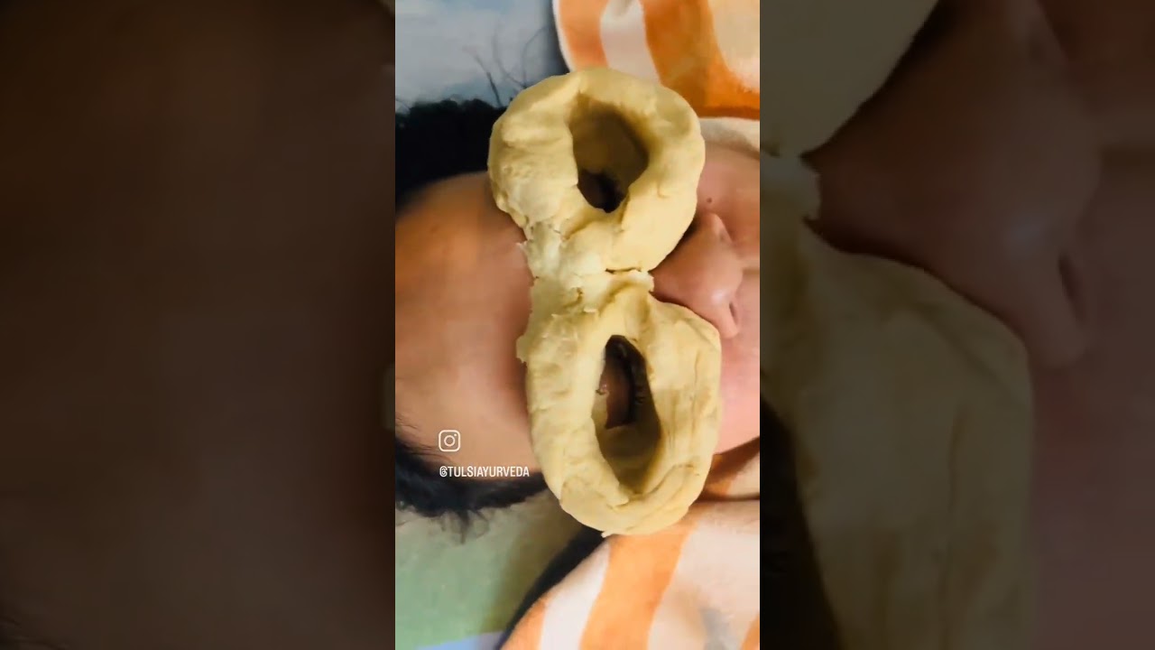 Eye Treatment in Ayurveda - Akshi tarpan | panchkarma | better vision | cataract